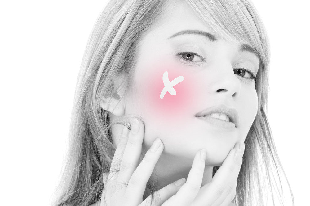 Treating Melasma: Prescriptions or Over-the-Counter? – Fair & Flawless